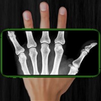 X-Ray Scanner for Android - Download the APK from Uptodown