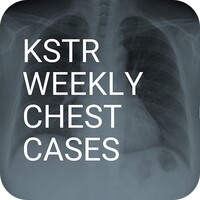 KSTR Weekly Chest Cases for Android - Download the APK from Uptodown